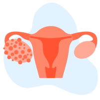 Ujian Risiko Kanser Ovari